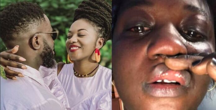 Mia des « Maabo » sauvagement battue par son ex mari ? Les images qui choquent (photos) - Dakarmidi